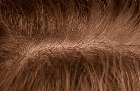 Afro Hair Systems - The Truth About Texture Matching